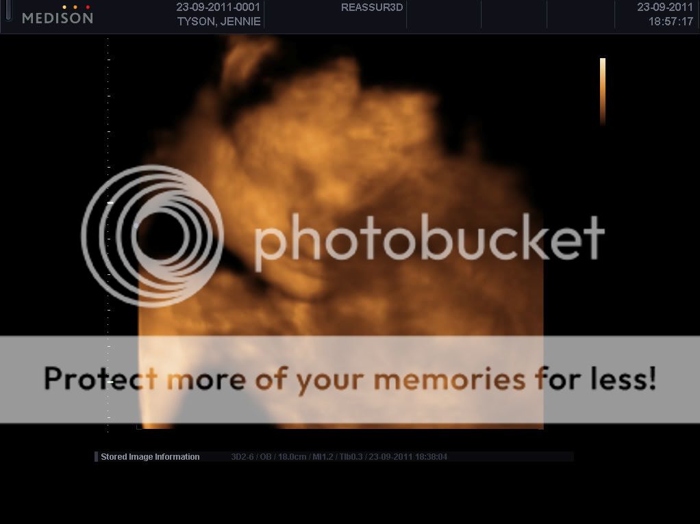 4d Scan – 27 Weeks 3 Days | From Beanie To Baby