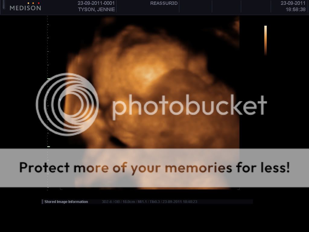 4d Scan – 27 Weeks 3 Days | From Beanie To Baby